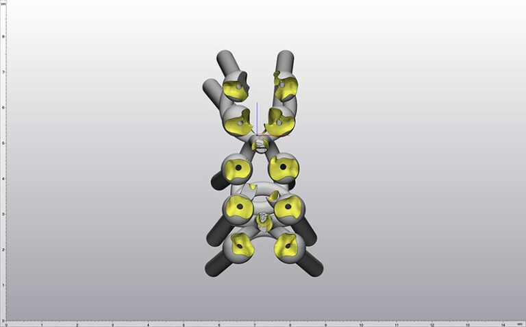 Spine-guide-01 - Cartesian Medical