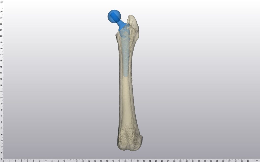 THR Template 04 - Cartesian Medical