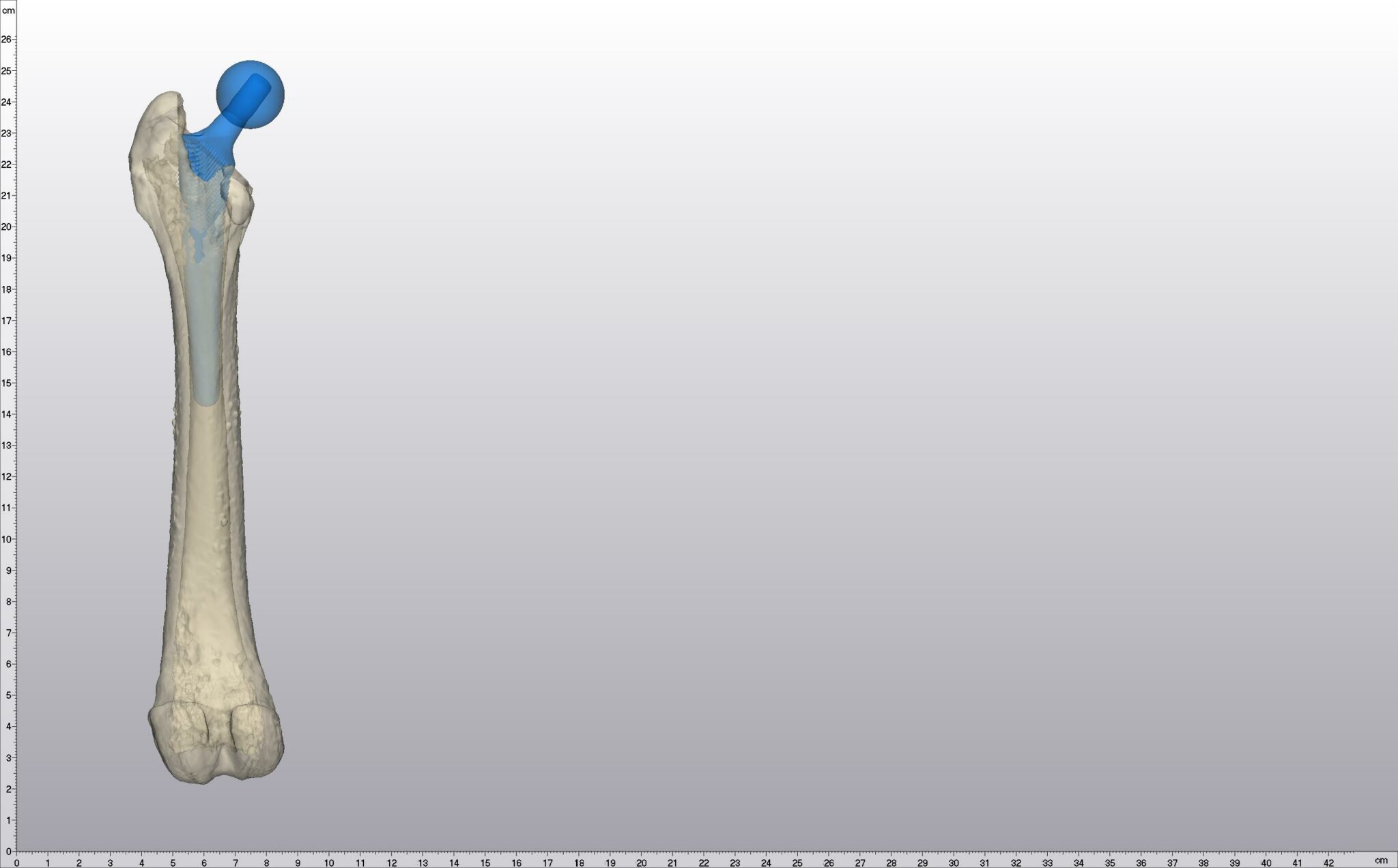 THR Template 06 - Cartesian Medical